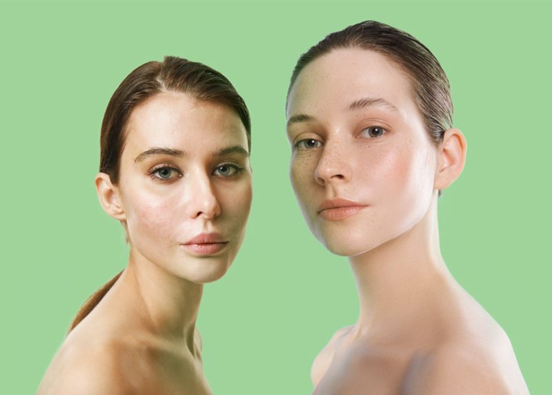 Dermactive – Feel better in your skin